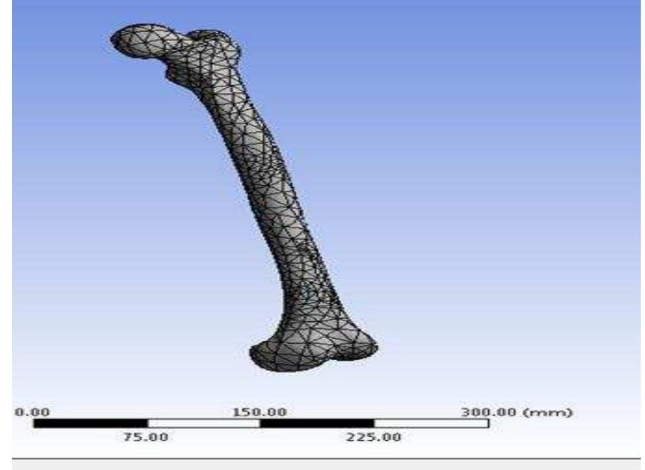 Mesh generation on femur os eo “— human bone is highly