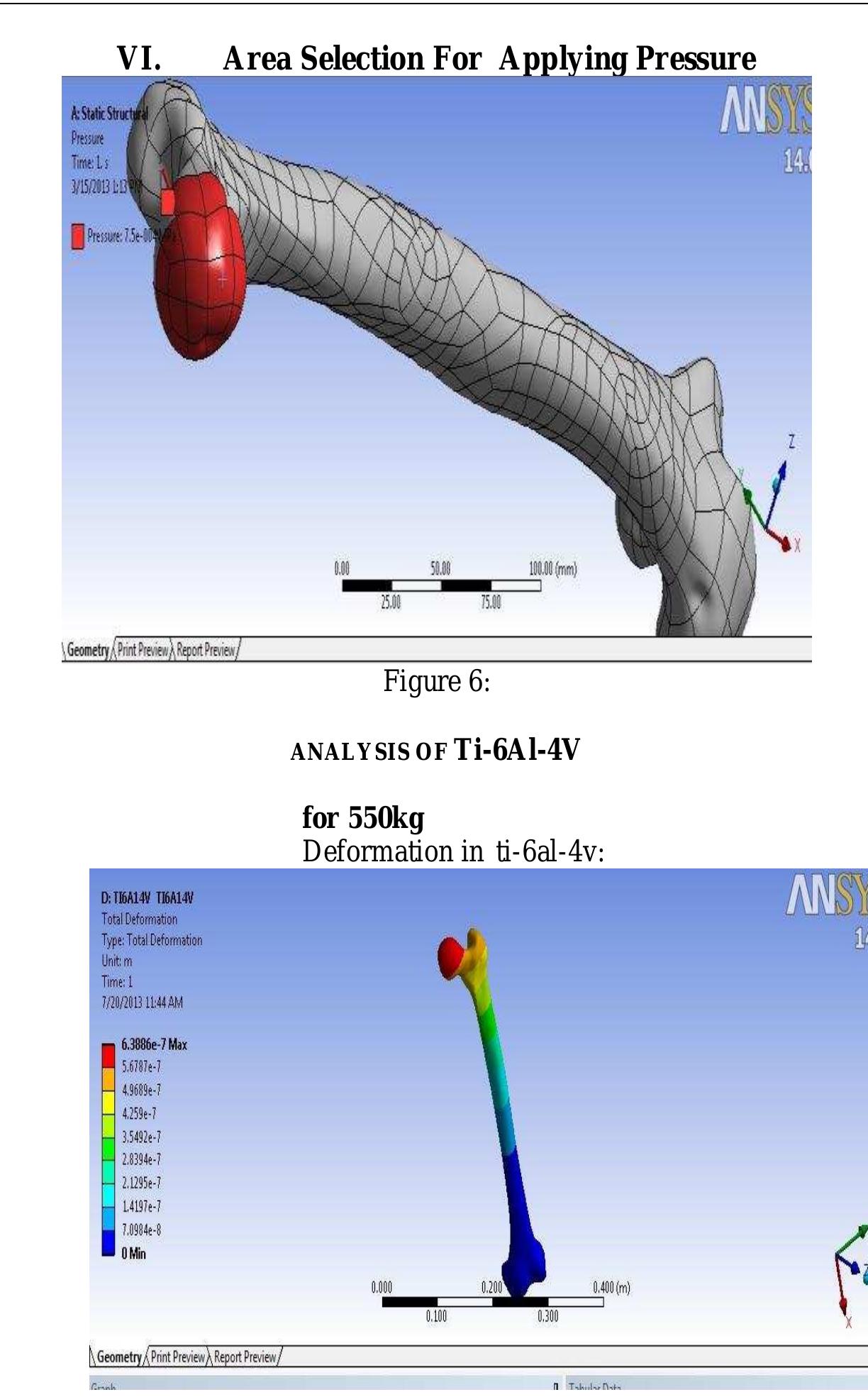 Modelling and static analysis of femur bone by using