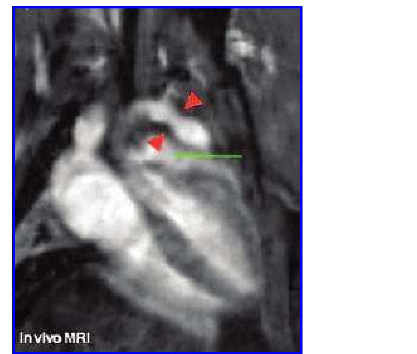 10: mri of mice with atherosclerosis—in the presence of