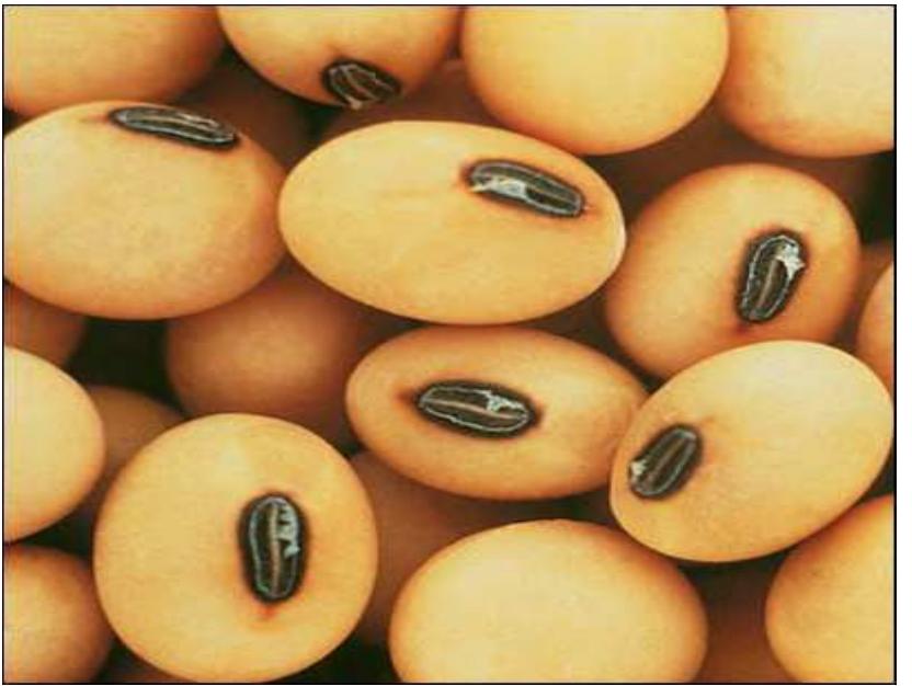 Proper intake of essential fatty acids derived from