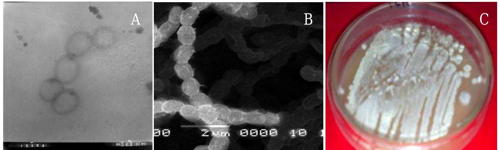 A and b: the cyst and spore chain of the selected bacteria