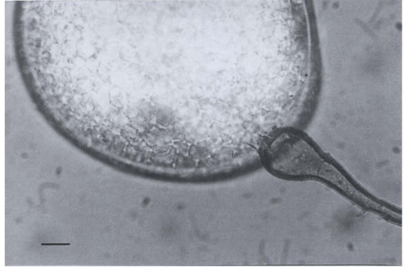 Figure 55 - from APPLIED MYCOLOGY AND BIOTECHNOLOGY