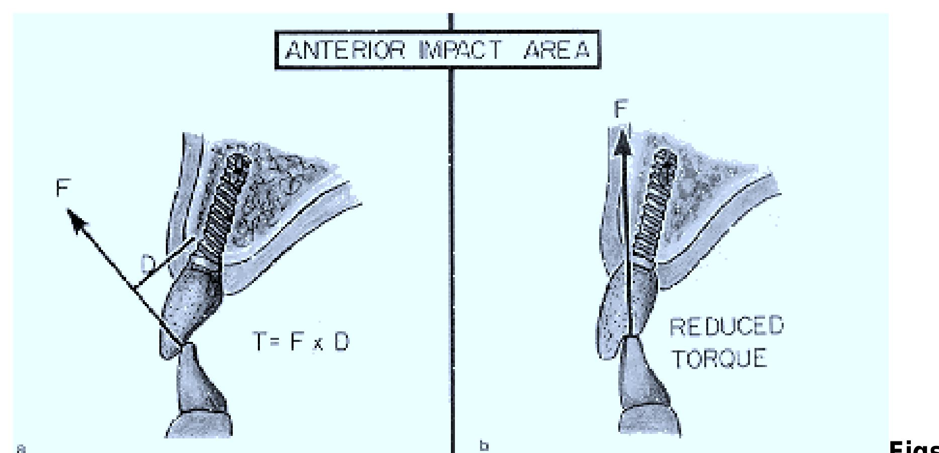 : comparison of torque production in natural and