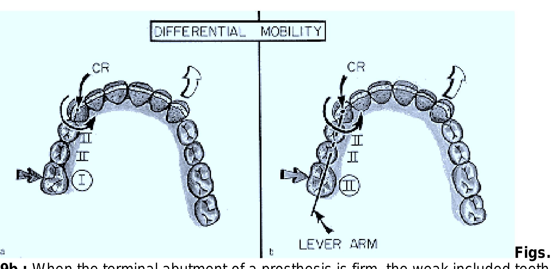 Figure 10 - The Biomechanics of Force Distribution in