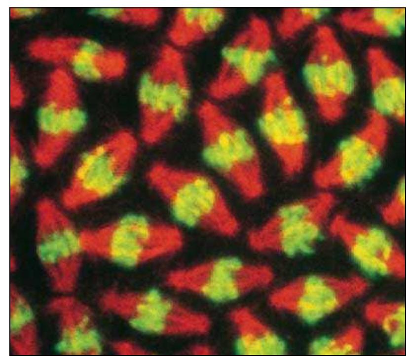 Dividing cells seen with a fluorescence microscope after