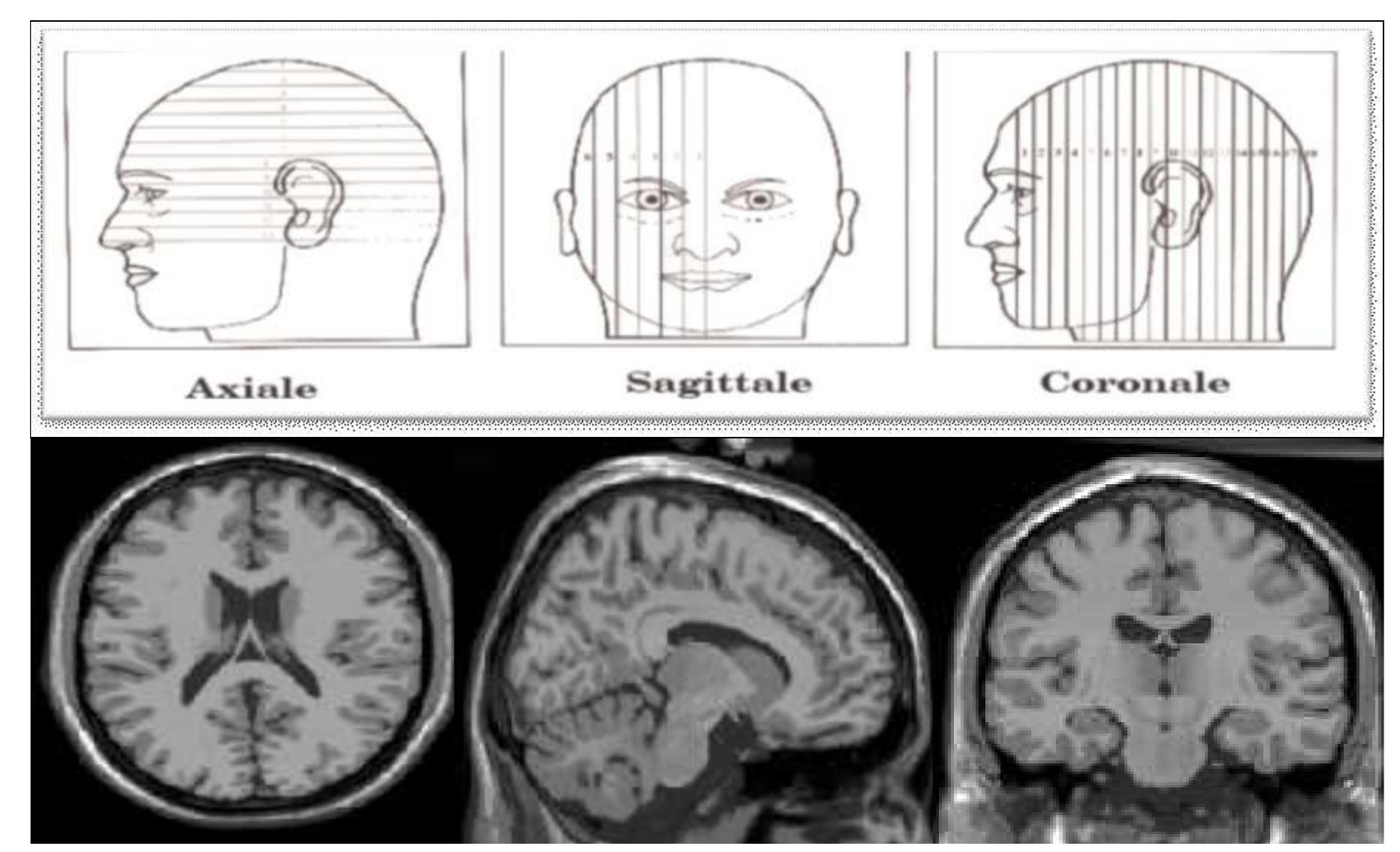 The images below show this cerebral segmentation: the brain