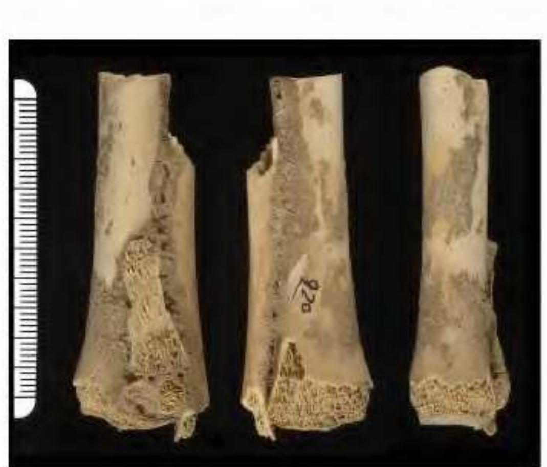 Anterior, posterior, and medial views of the shanidar 10