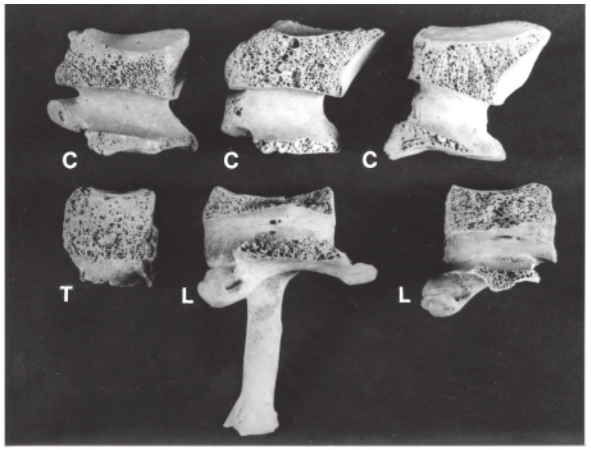 A agar a caprine cervical (c), thoracic (t) and lumbar (l)