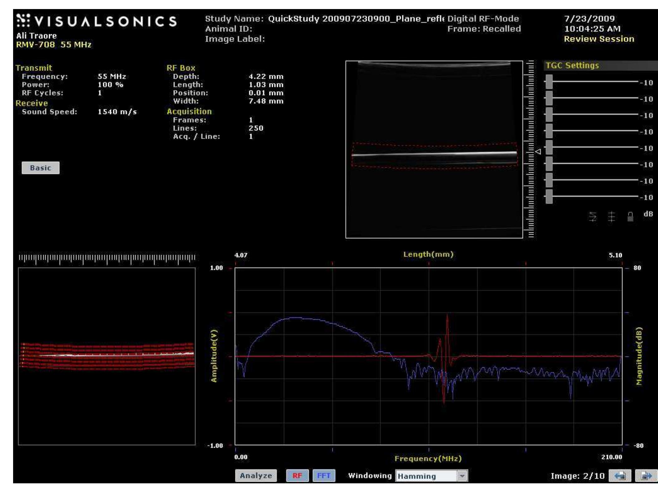 : screen of the vevo 770 ultrasound scanner. the rf box