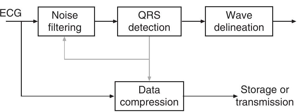 Algorithms for basic ecg signal processing. the timing