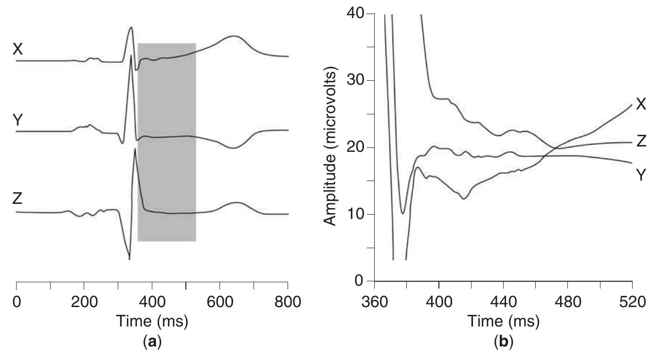 Ensemble averaging to avoid smearing of low-amplitude,