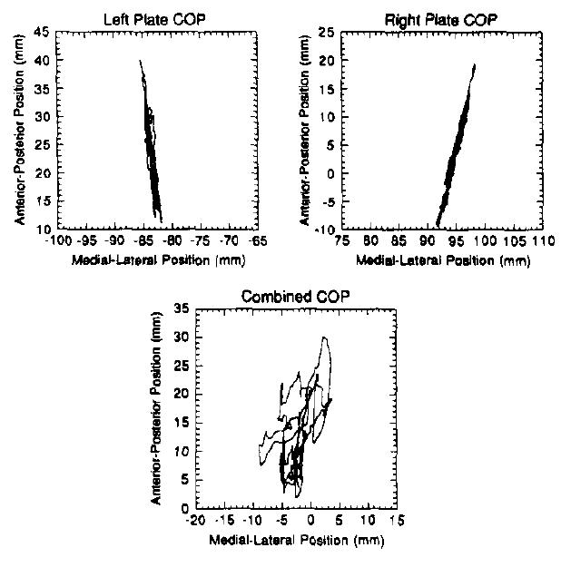Position of the center of pressure (cop) for left foot