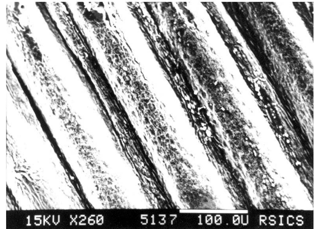 Scanning and transmission electron microscopy of the
