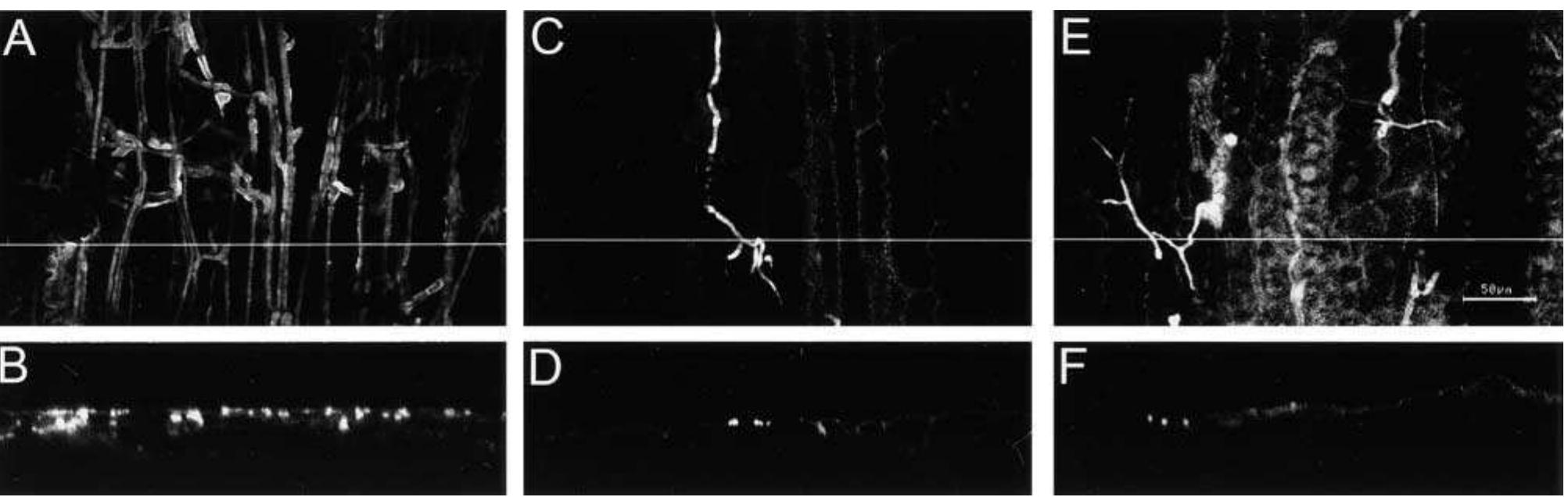 Fluorescence confocal microscopy of infection of maize