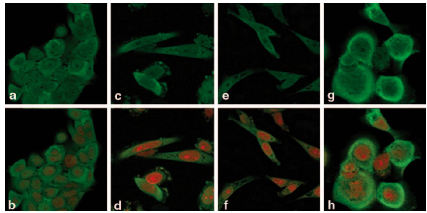 6 confocal microscopy images of cervical cell lines: a—b