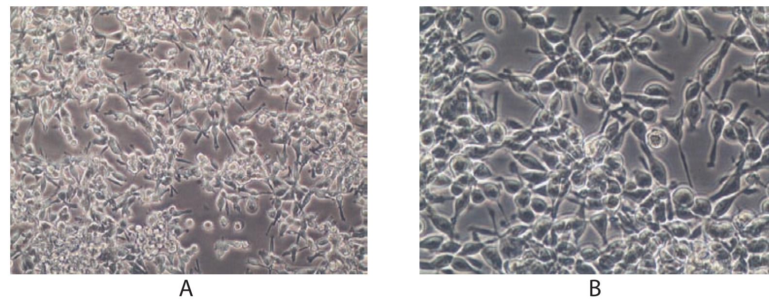 1. phase contrast images of healthy 293 cells in adherent