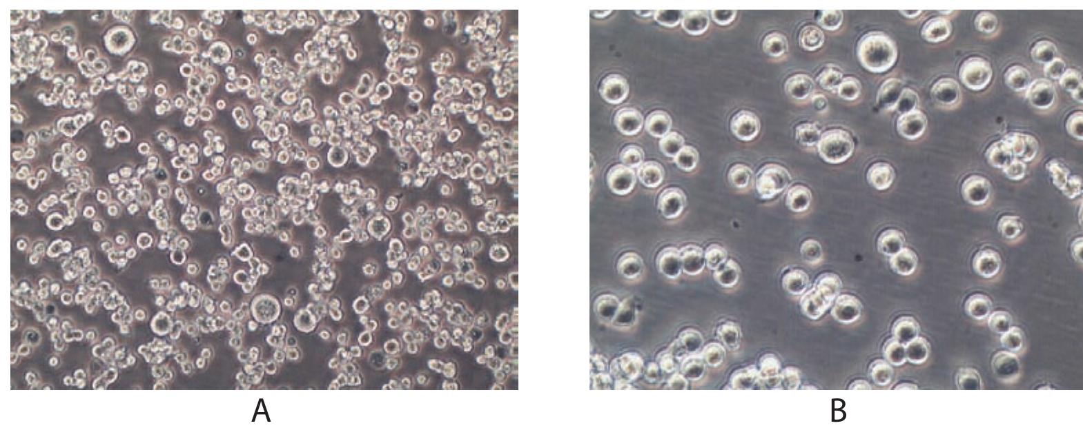 2. phase contrast images of healthy 293f cells grown is