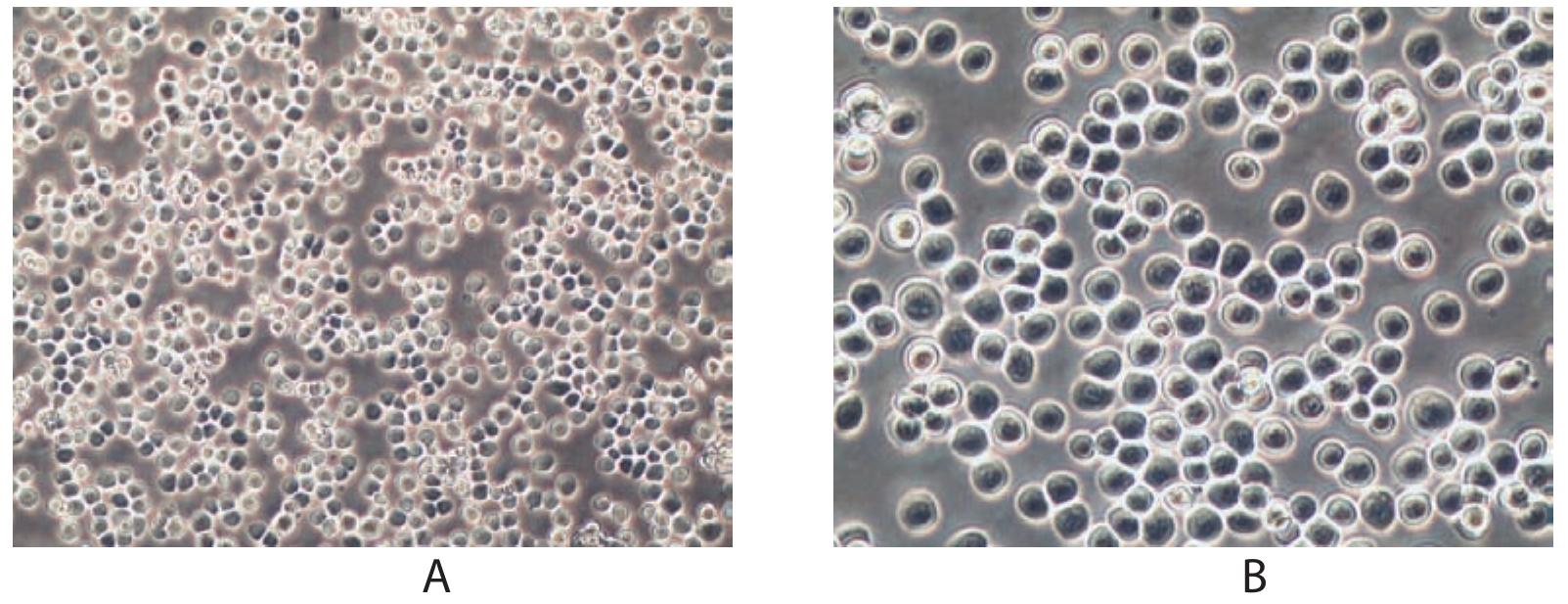 5. phase contrast images of healthy sf9 insect cells grown