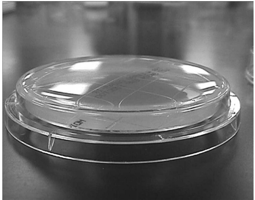 -15. example of a rodac plate. (courtesy of baxter health-