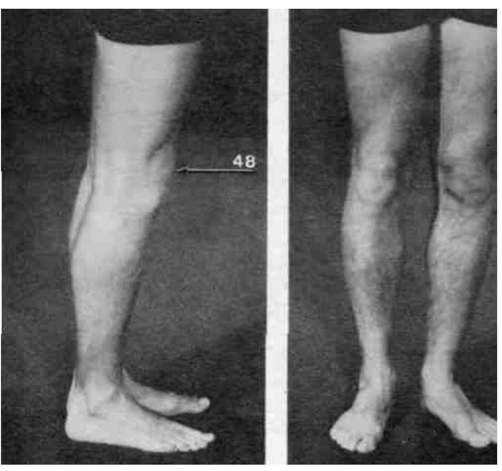 A kick made straight in at the knee, as shown in 48 more