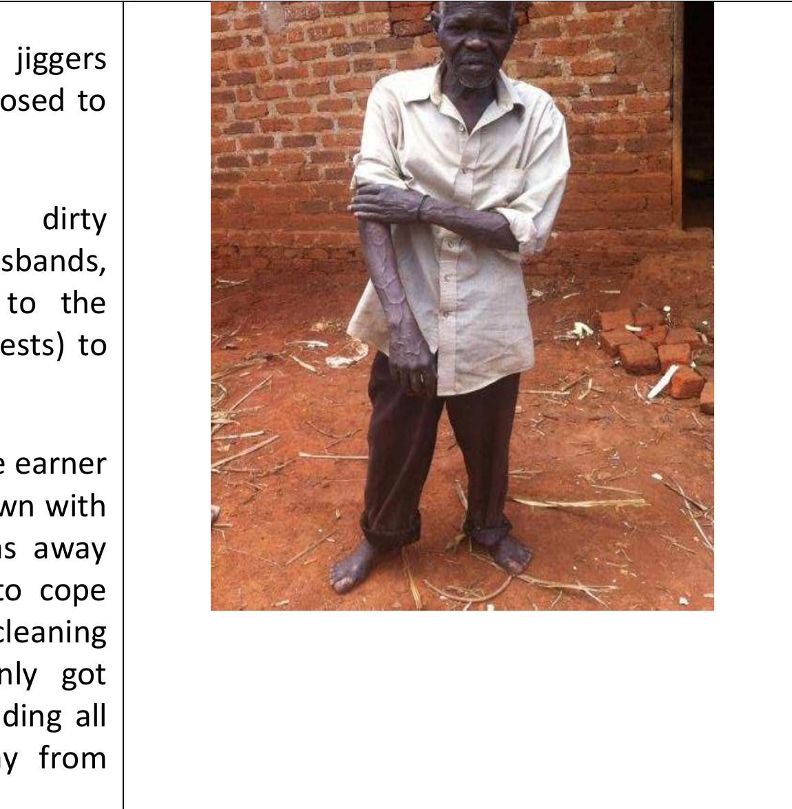 8. jiggers: the international identity of busoga region: the
