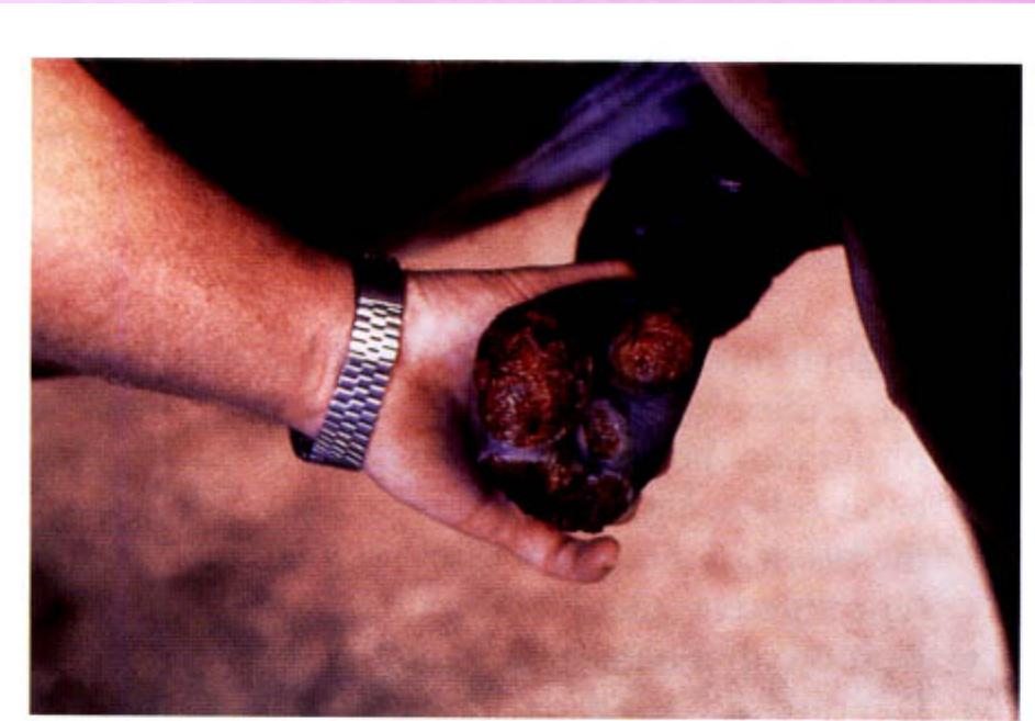 45 habronemiasis of the glans penis (and urethral fossa in