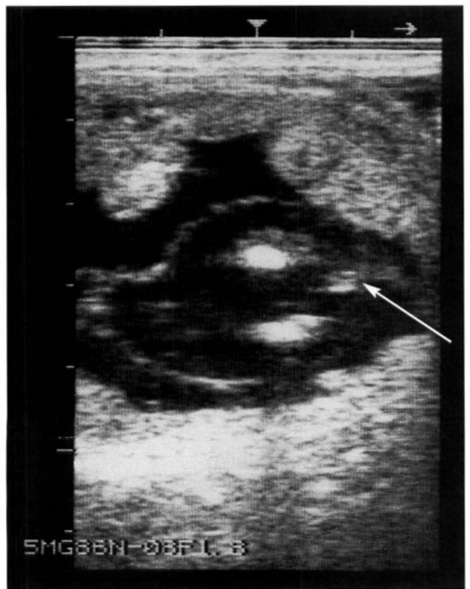 Figure 204 - from Equine Stud Farm Medicine and Surgery