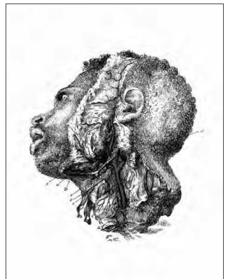 Plate iv, an engraving of the arteries of the head, from