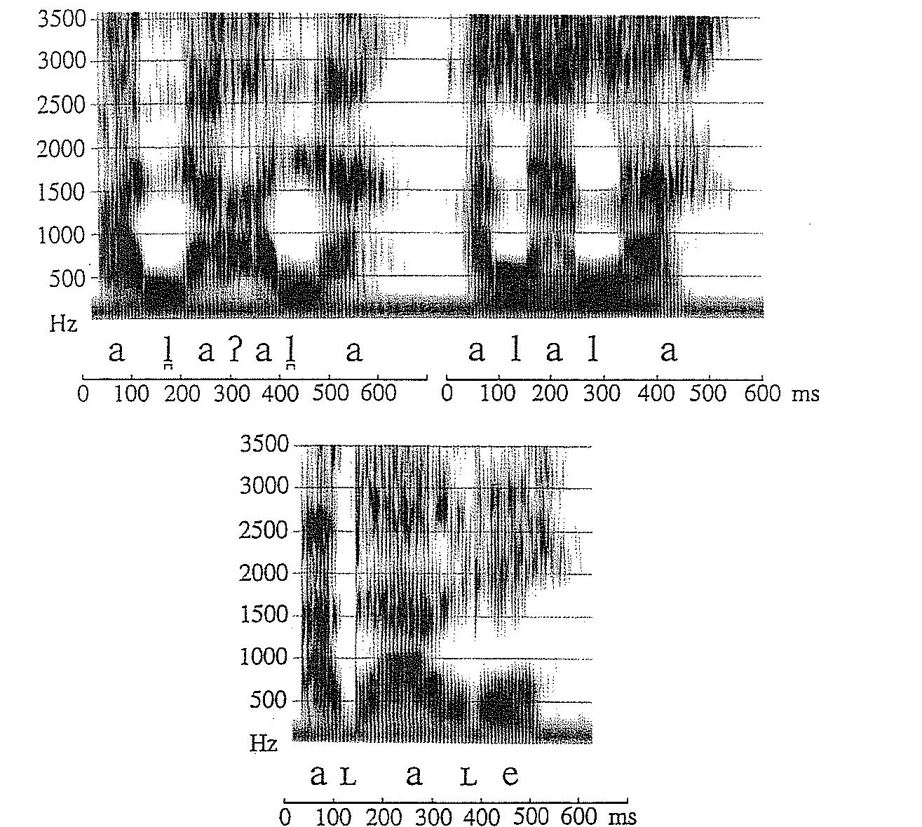 9 spectrograms of laminal dental, apical alveolar and velar