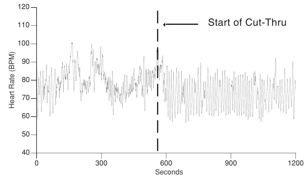 This graph is a typical hrv example from one of the subjects