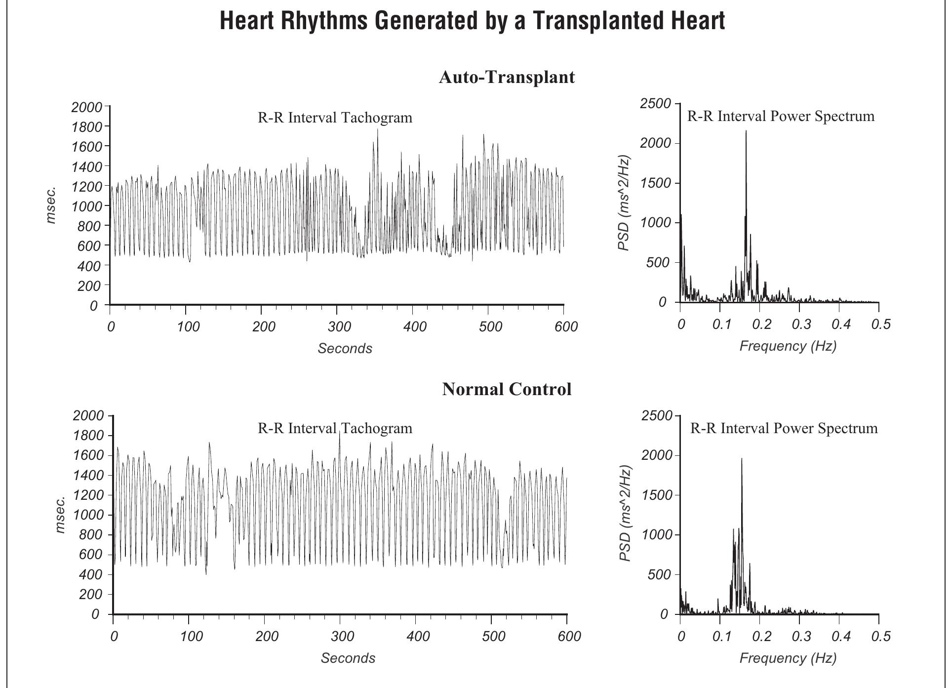 At top left is the heart rate tachogram of a dog after