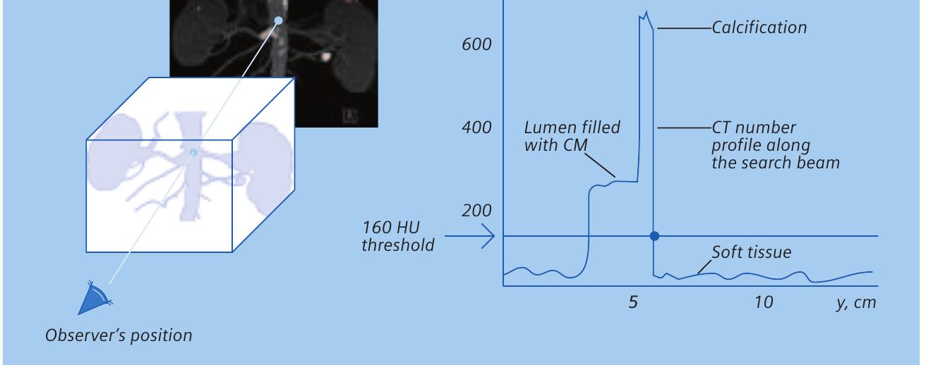 ¢ maximum intensity projection (mip) through the 3d image