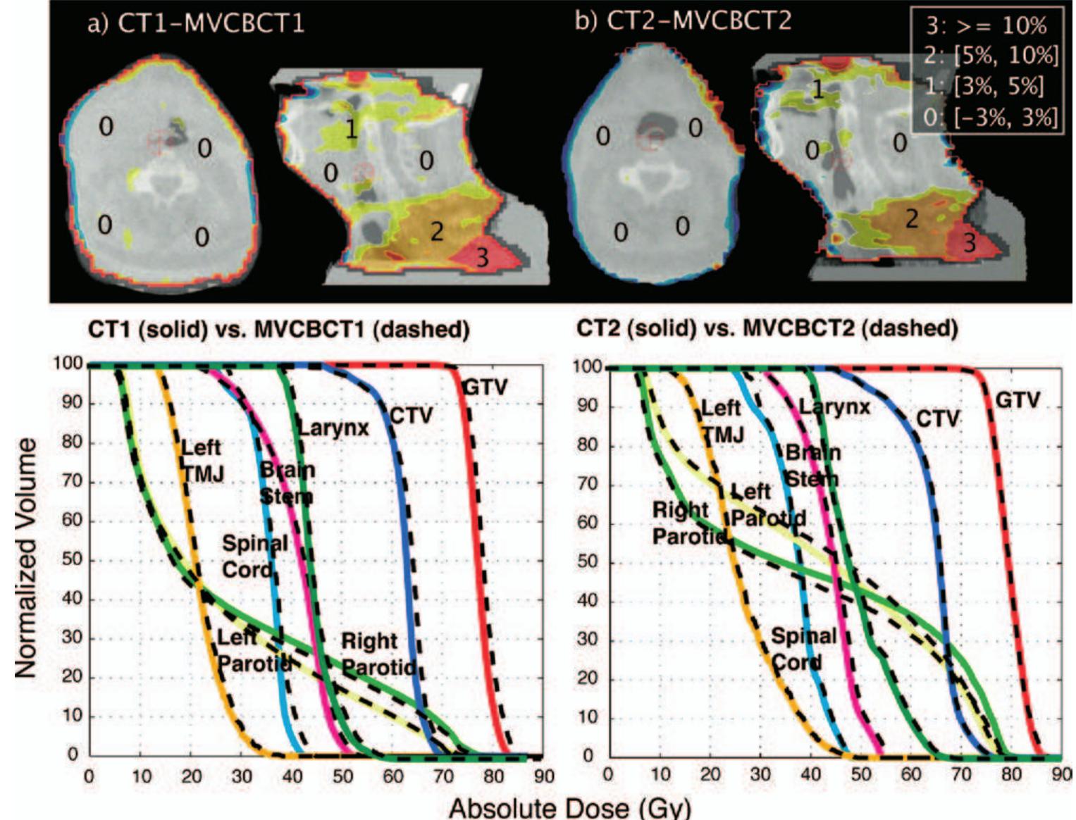 (top) axial and sagittal images crossing isocenter showing
