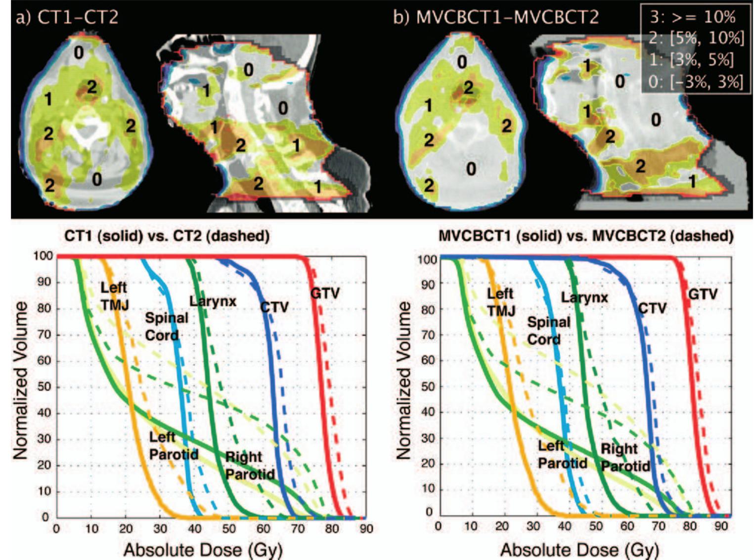 (top) axial and sagittal images crossing isocenter showing