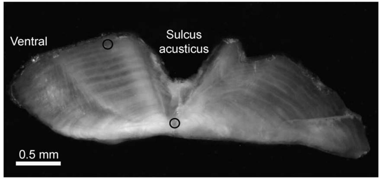 Transverse section of an otolith of a nine year old