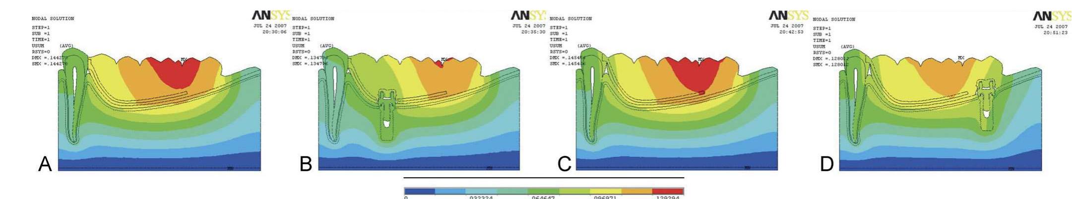 A, model |. b, model j. c, model k. d, model l.