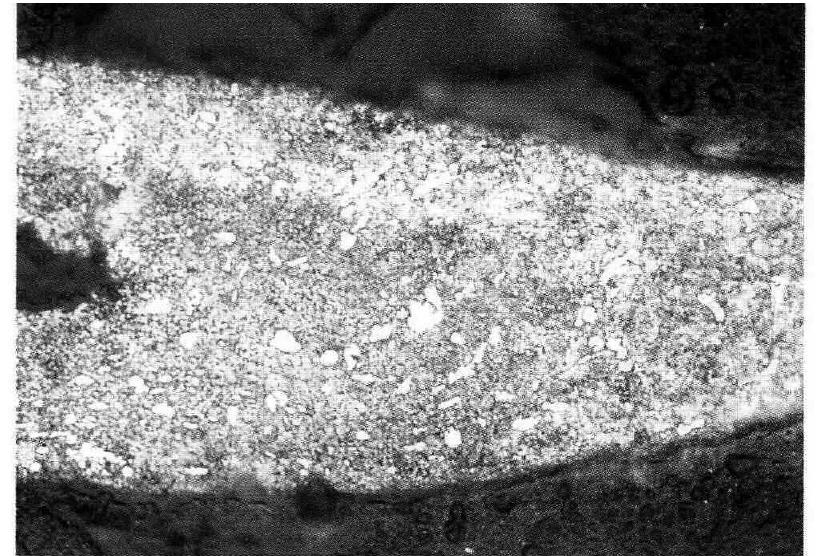 Photomicrograph of part of the teeth of the crown, showing a