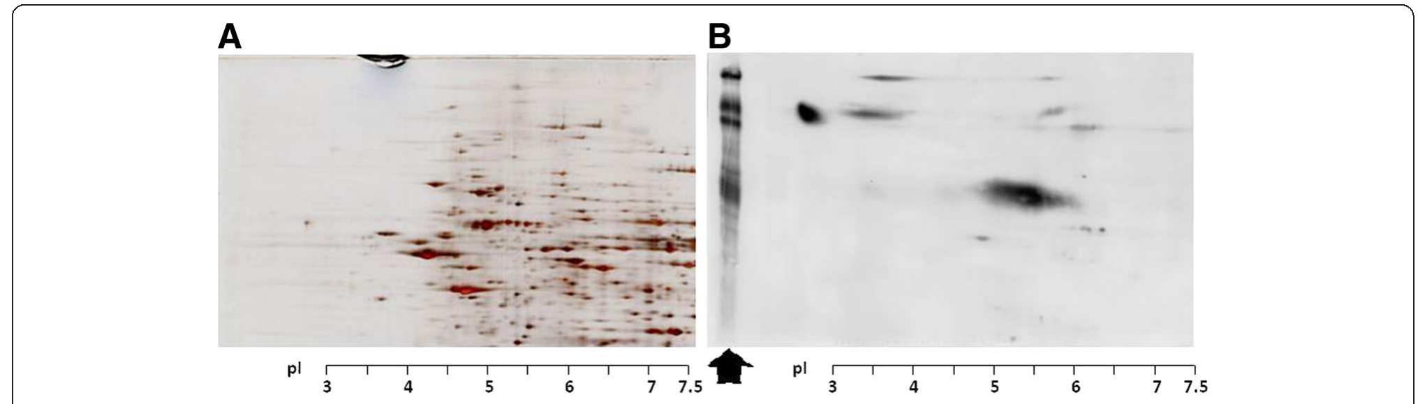 2-de showed the resolving of glomerular proteins using 7 cm