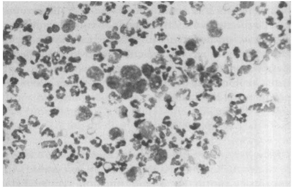 -2. cytology of vulvar discharge from a dog with open cervix