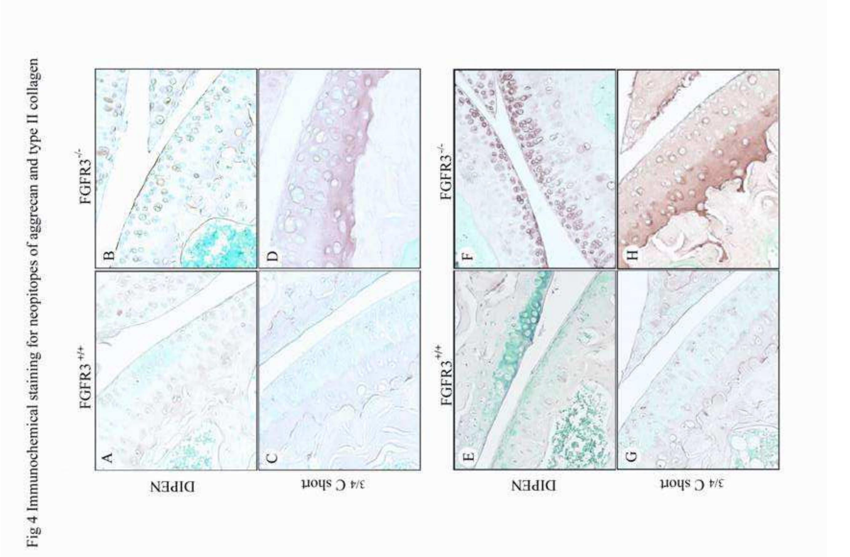 Figure 4 - Defects in articular cartilage metabolism and
