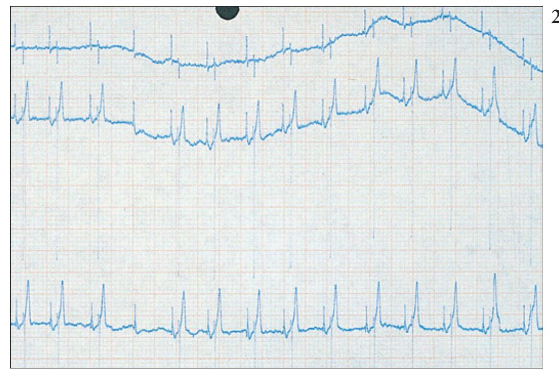 29 electrocardiography is an indispensable tool for the