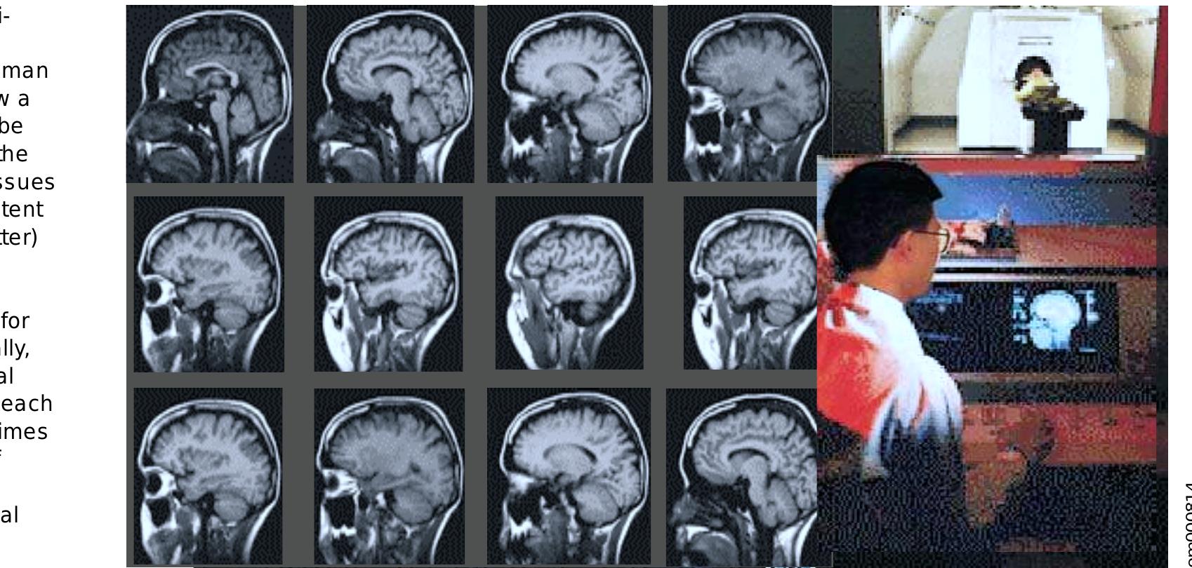 Figure 3 - NMR+Logging+Principles+and+Applications