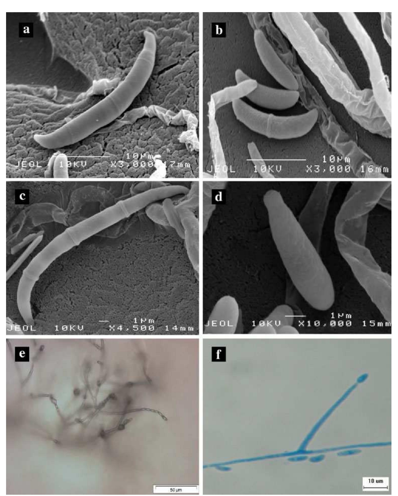 Sem images of macroconidia (a) and microconidia (b) of