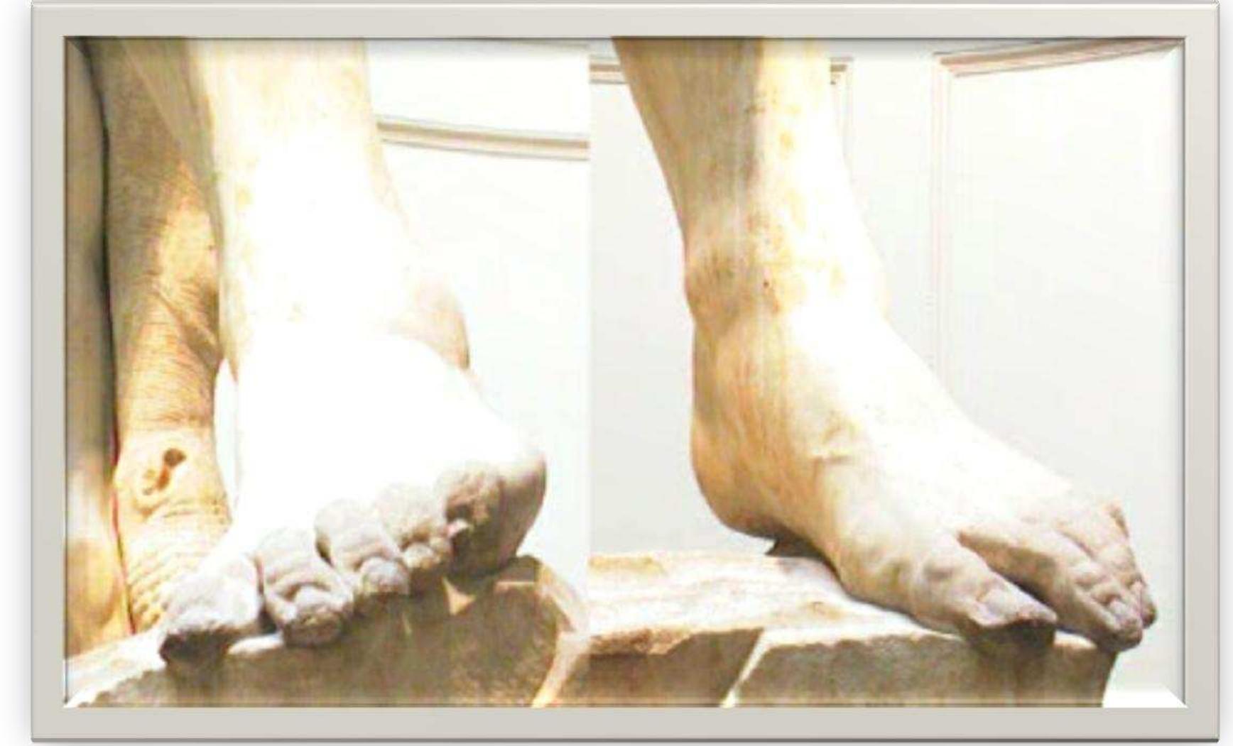 Damage sustained to the left foot of michelangelo’s david,
