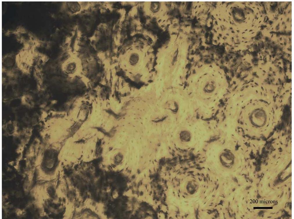 Micrograph of a human femoral thin section sampled from an