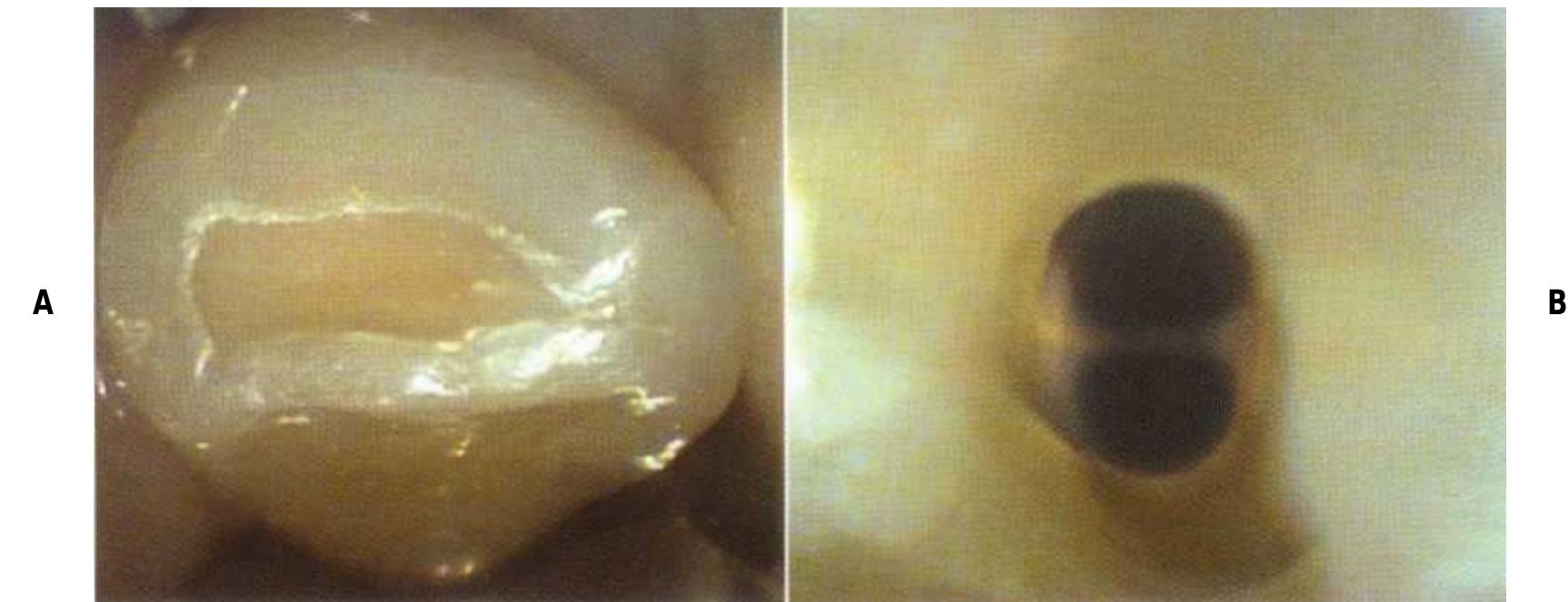 (PDF) Color Atlas of Endodontics