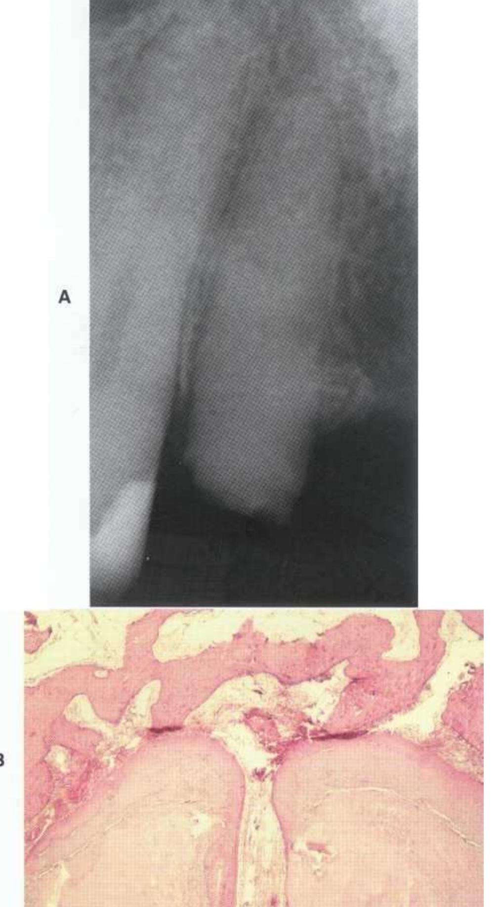 -4 radiograph (a) and histologic section (b) of ideal apical