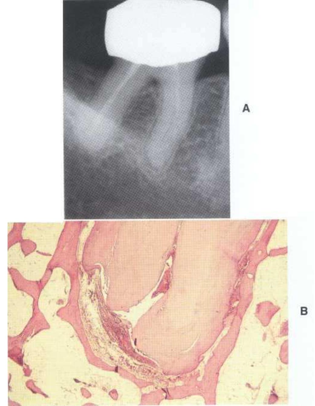 -igure 3-10 radiograph (a) and histologic section (b) of