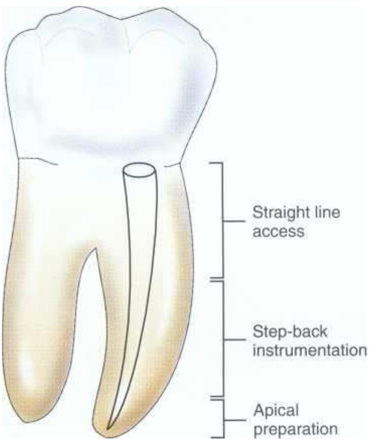 -10 canal preparation can be thought of in three phases: 1)
