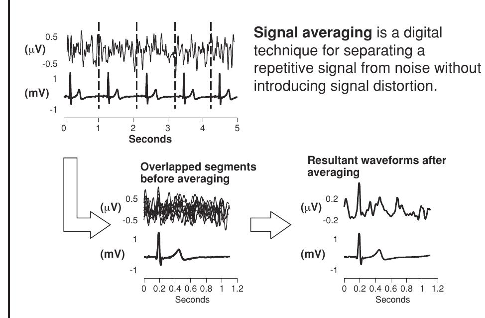 The sequence of the signal averaging procedure is shown